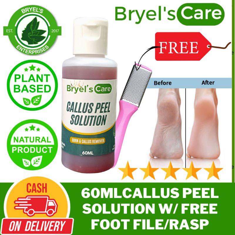 Bryel'sCare 60ml CALLUS REMOVER SET(CALLUS PILE AND CALLUS REMOVER SOLUTION) KALYO PEEL SOLUTION ...