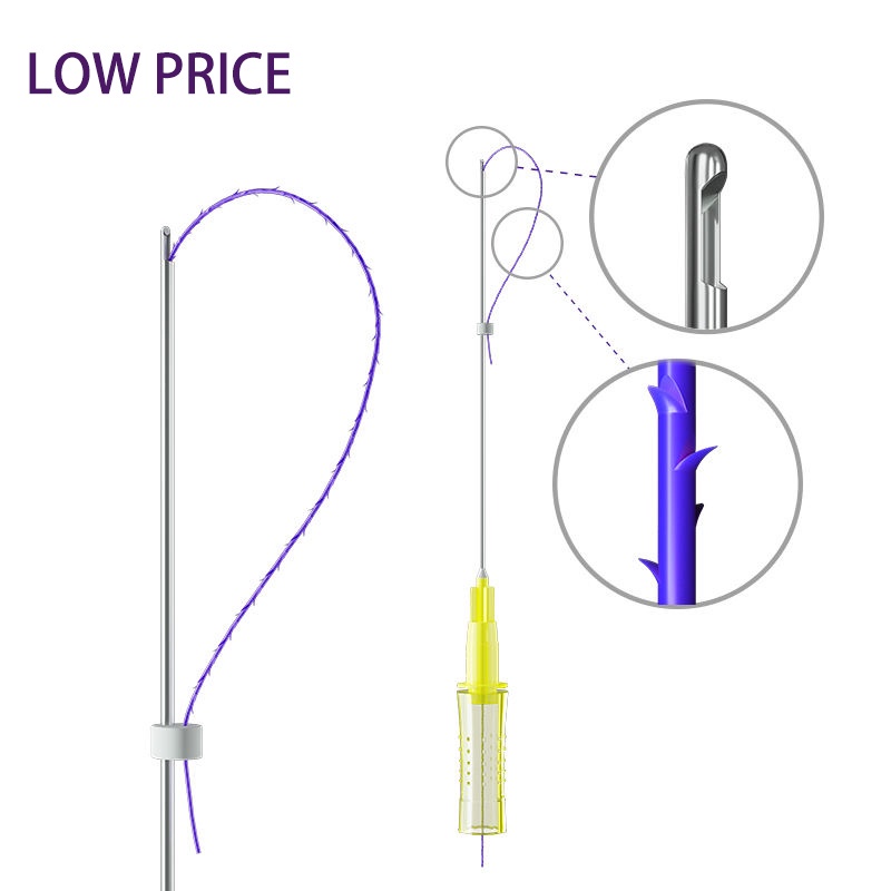 Smoker lines lift PDO thread mono tornado screw easy safe new beauty product korae 26G 60mm ...