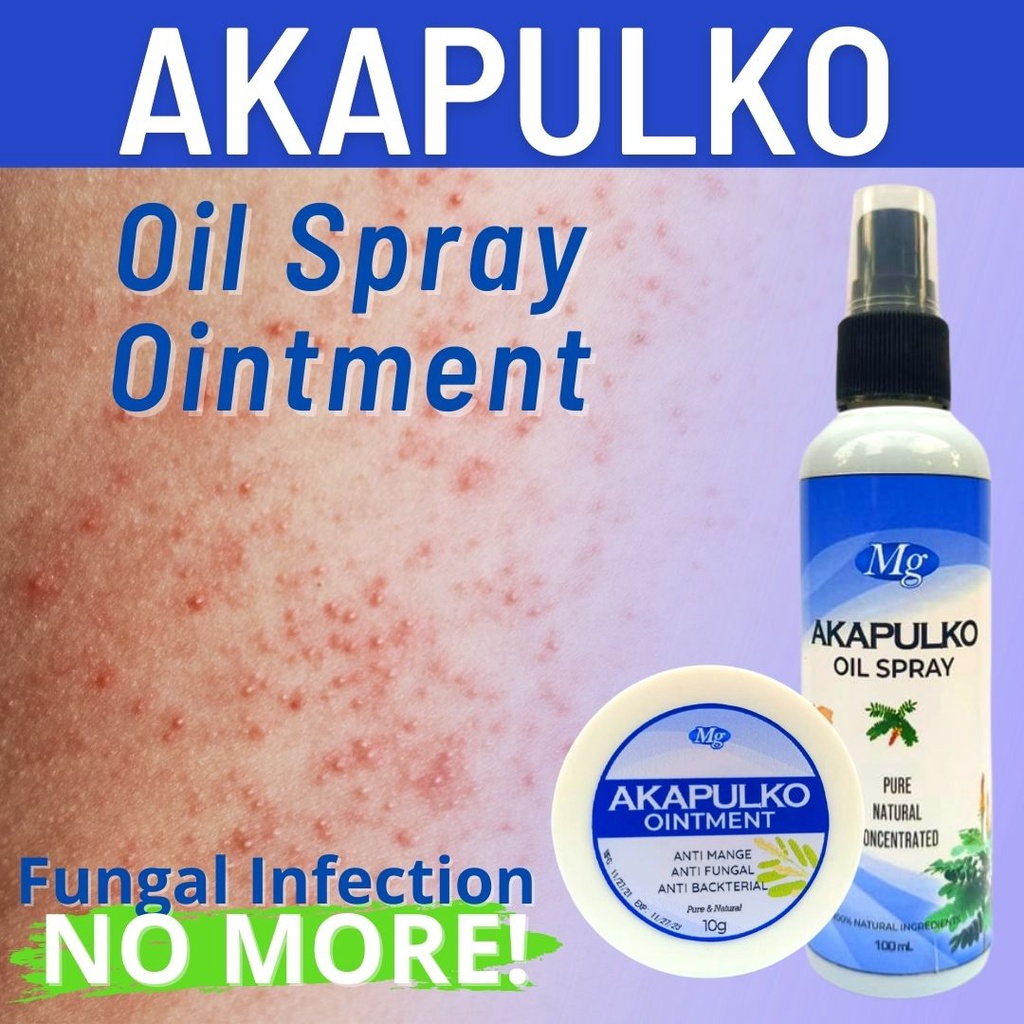 AKAPULKO BUNDLE SET | AKAPULKO OIL SPRAY AND OINTMENT | HELPS ...
