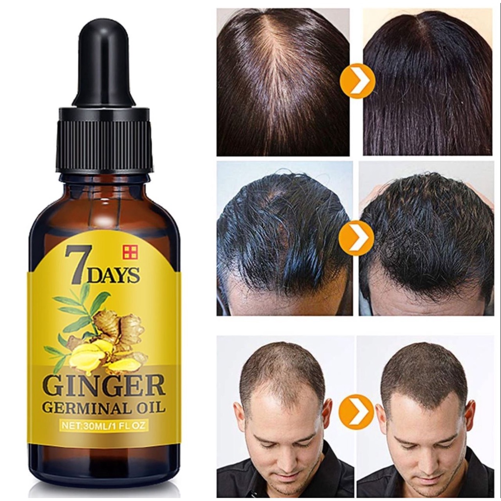 7 Days Ginger Germinal Oil Ginger Hair Growth Essence Hair Loss Liquid
