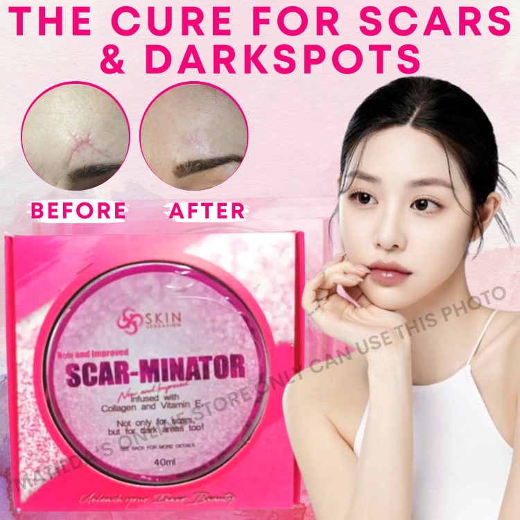 Original Skin Sensation Scar Minator Cream 50ml Scar Removing Cream ...