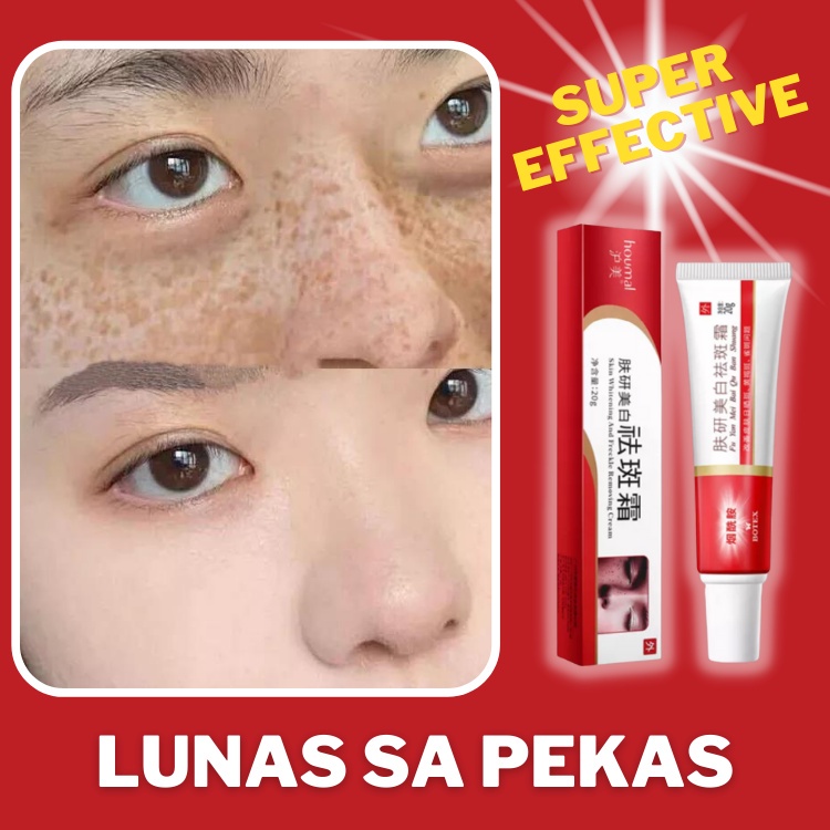 Melasma Cream Pekas Remover Collagen Japan Pekas Remover Original Pekas ...