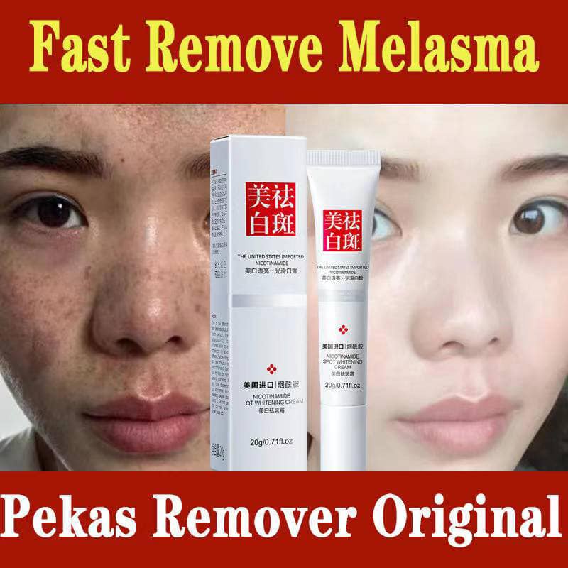 Melasma Cream Pekas Remover Original Collagen Pekas & Freckles Remover ...