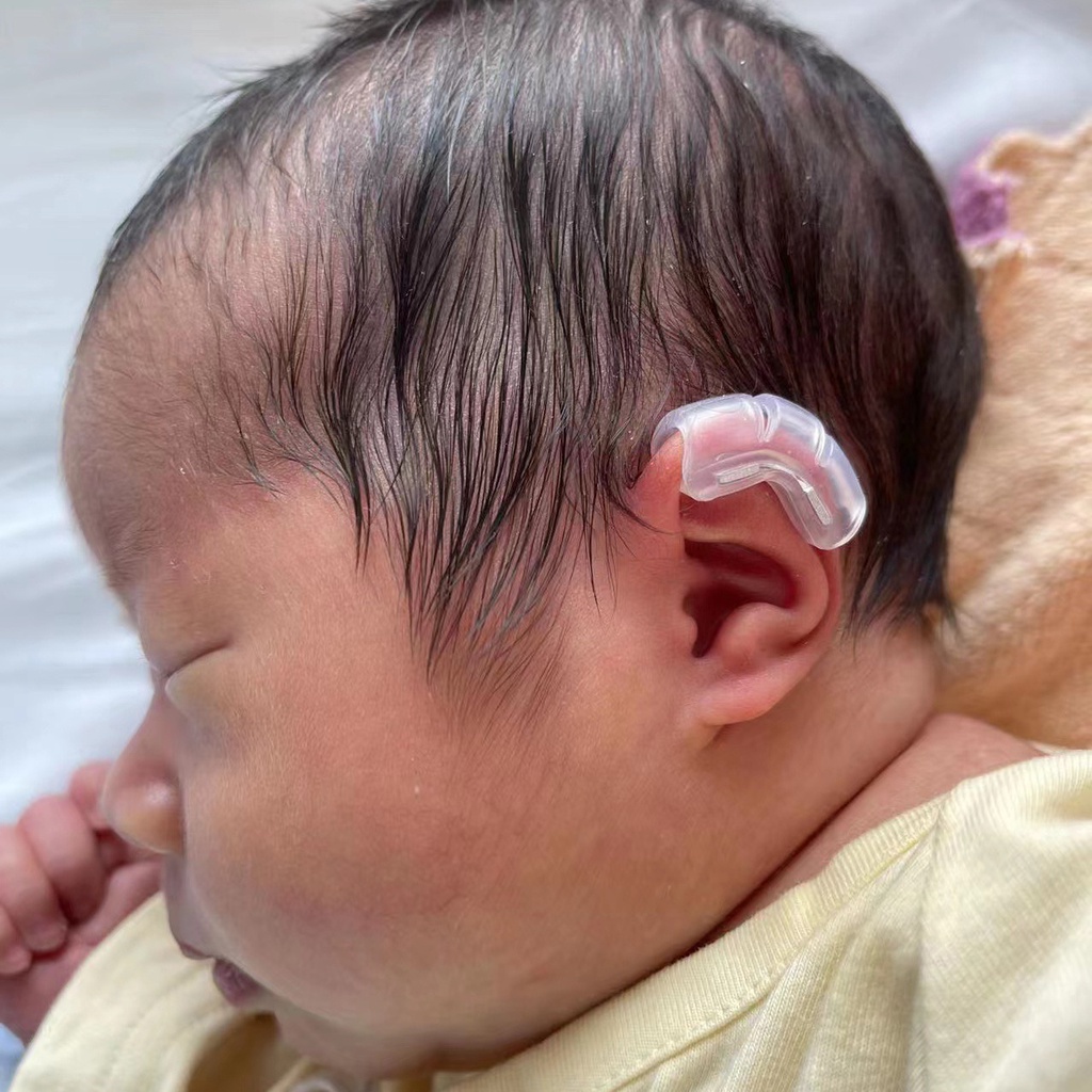 Newborn Ear Corrector Baby Sticker Profile Correction Shaping Wheel ...