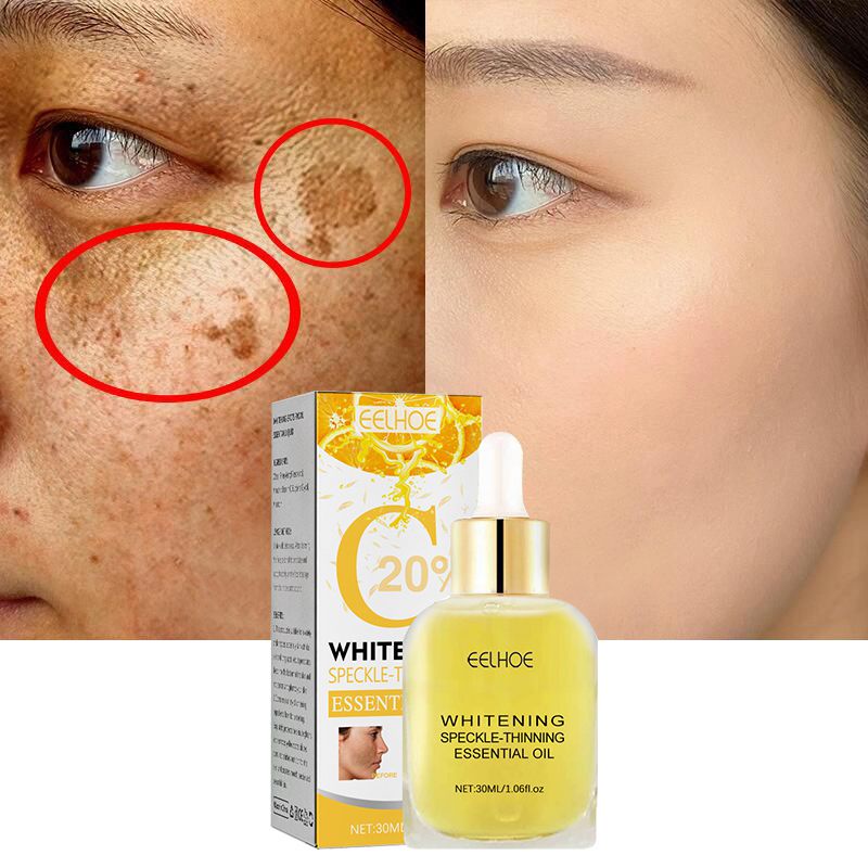 Vitamin C Freckle Removal Whitening Face Serum Fade Dark Spot Melasma Pigment Melanin Brighten ...