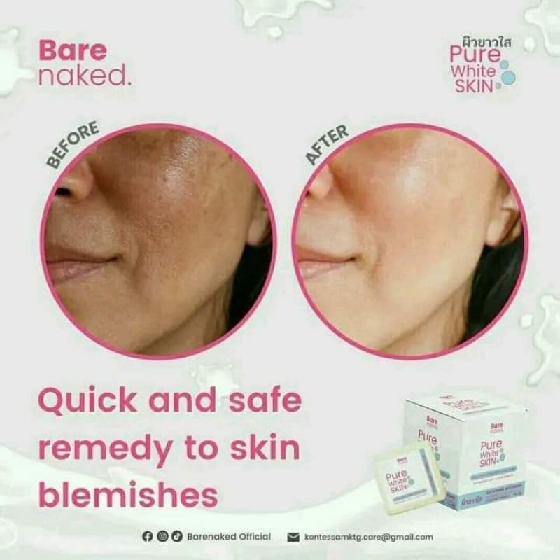 AUTHENTIC BARENAKED PURE WHITE SKIN SOAP | Shopee Philippines
