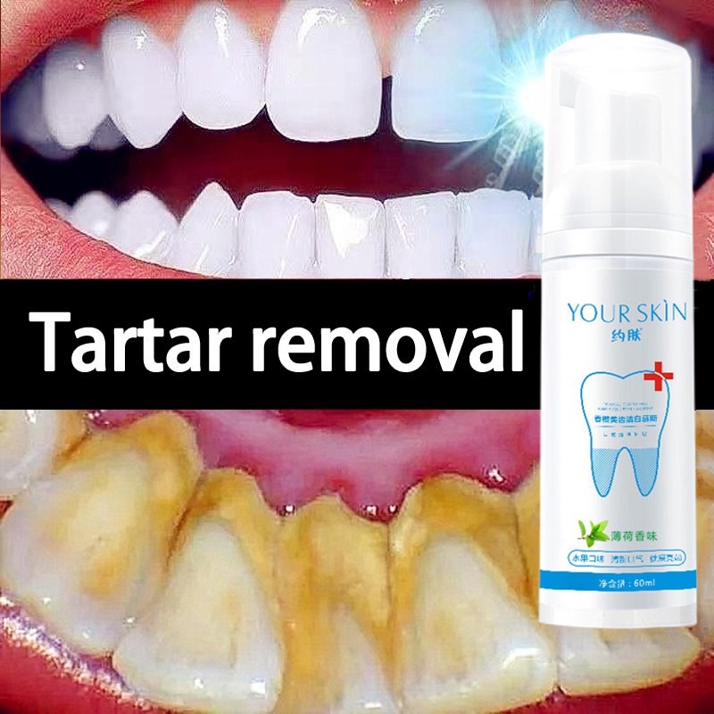 Teeth Whitening Mousse Remove Plaque Oral Odor Cleansing Teeth Mousse ...
