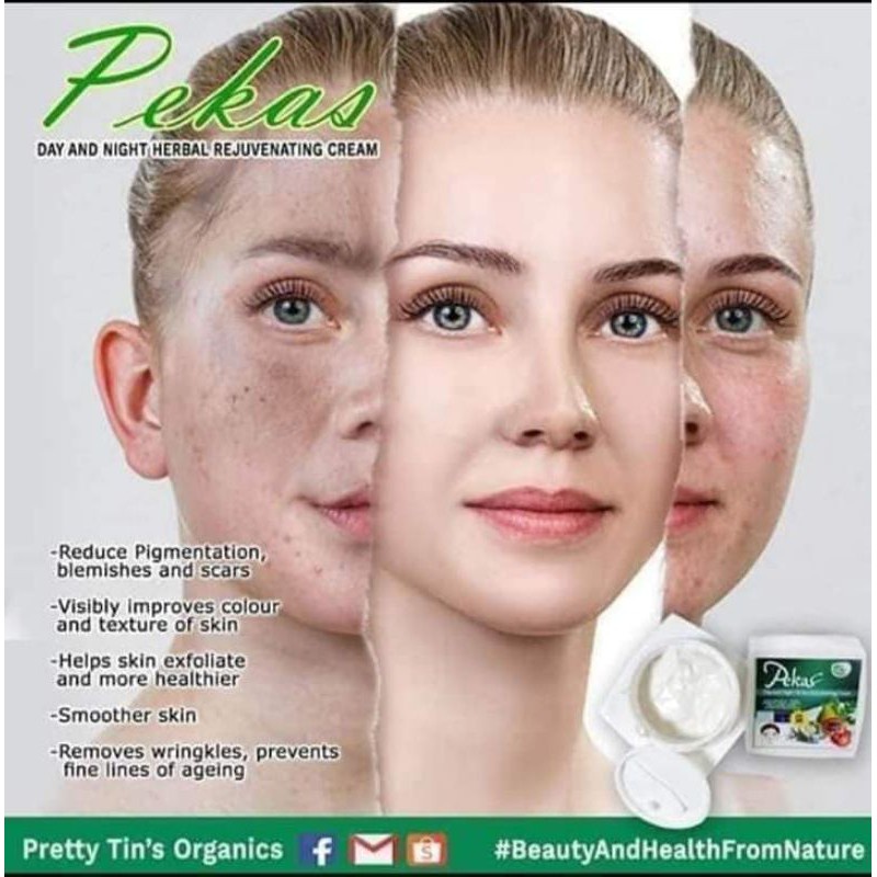 Para sa pekas /melasma | Shopee Philippines