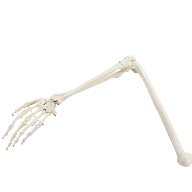 Human Upper Limb Arm and Radius Hand Bone Anatomy Model Medical Science ...