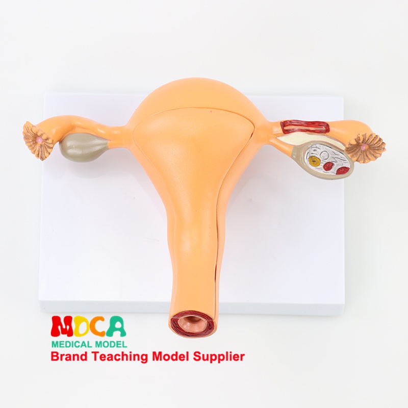 Medical teaching of anatomical model of uterus and genitalia in family ...