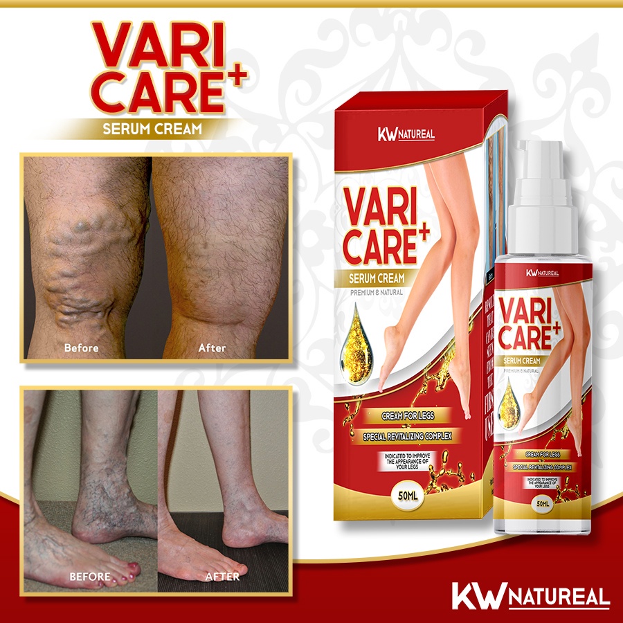 VARICARE PLUS Serum Cream Dual Effective Varicose Vein Cream, Spider ...