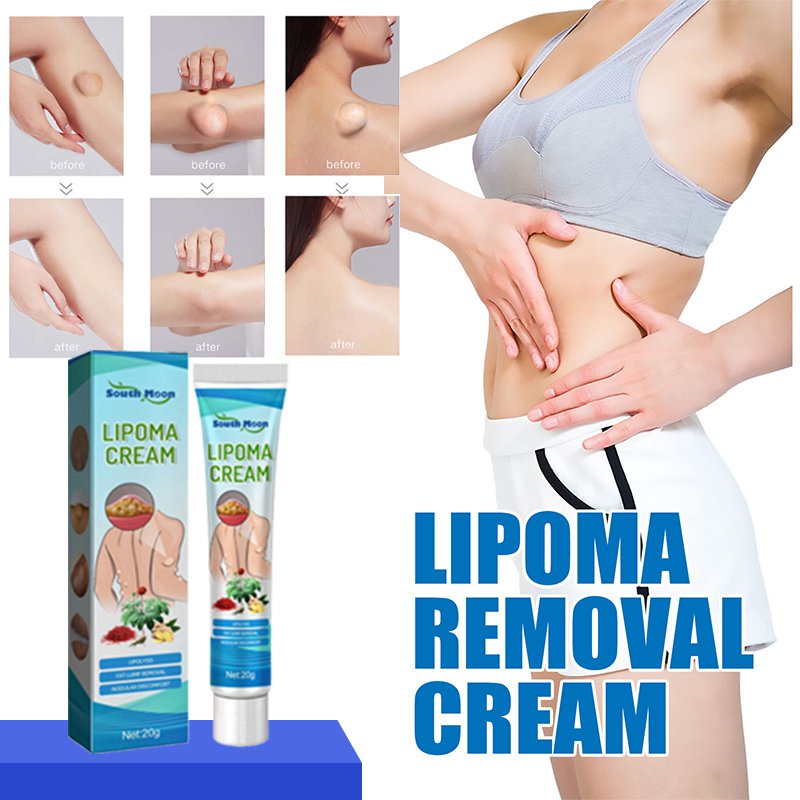 Lipoma Removal Cream Relief Pain Treat Skin Swelling Lipolysis ... Lipoma Removal Cream Relief Pain Treat Skin Swelling Lipolysis ...
