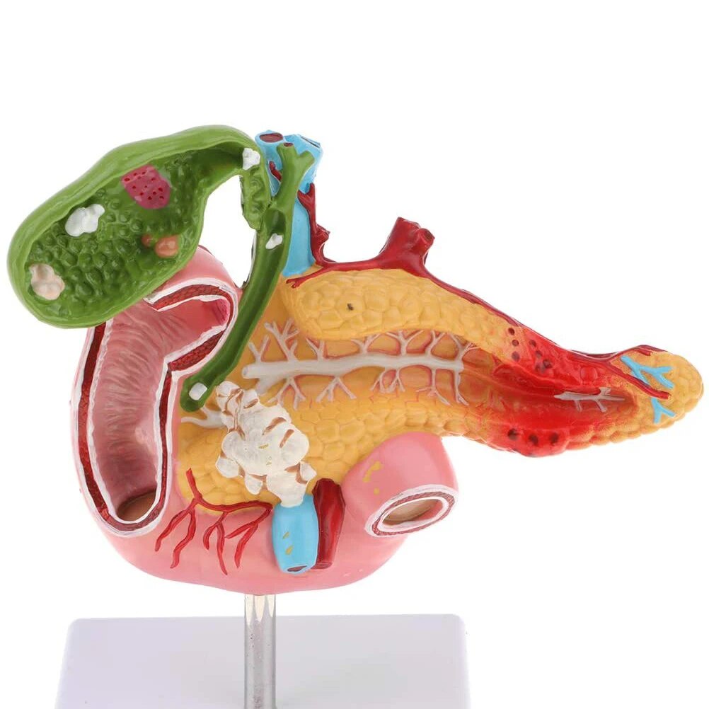 1:1 Life Size Anatomical Human Pancreas Duodenum Gallbladder Pathology ...