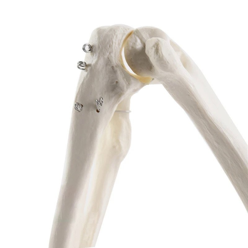 Human Upper Limb Arm and Radius Hand Bone Anatomy Model Medical Science ...