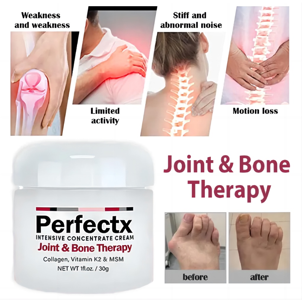 PERFECTX 30G Joint Bone Therapy Cream Joint Knee Pain Toe Bone Pain ...