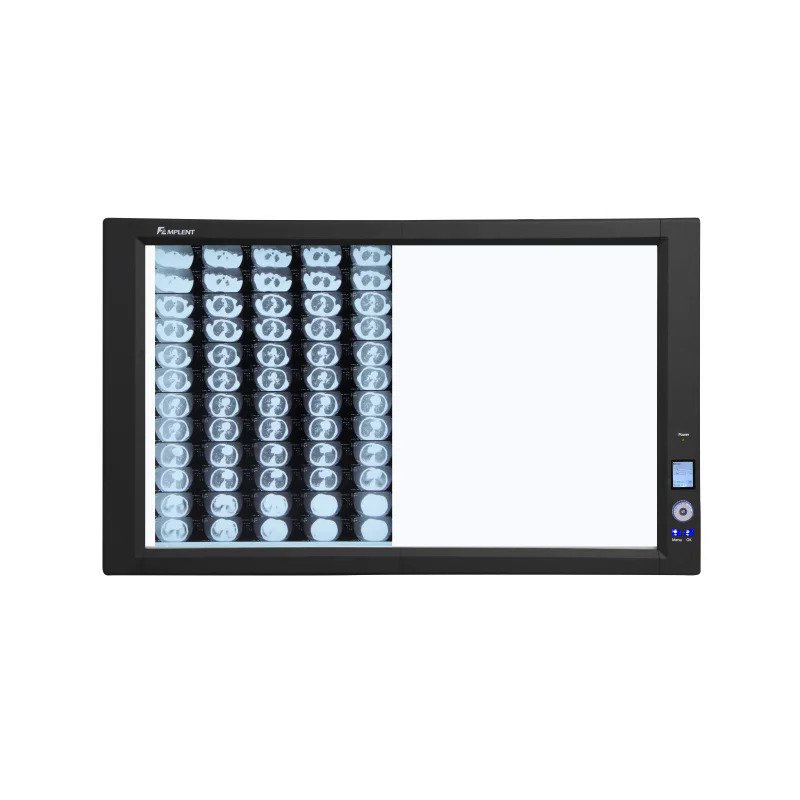 YSX-GPD01 Medical LED Film x-ray viewer x ray viewer box hospital xray ...