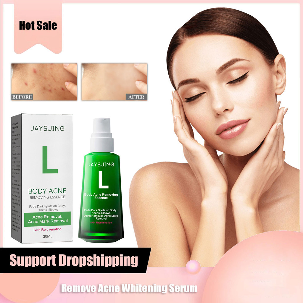 Acne Remover Face Serum Herbs Acne Treatment Pimple Remover Shrink ...