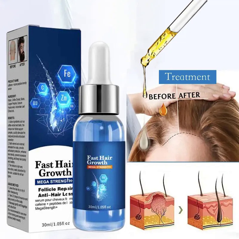 Fast Hair Growth Hair Growth Oil Effective Baldness Repair Hereditary