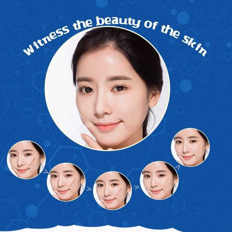 Scar Remover Gel Cream Fade Acne Scars Stretch Marks Repair And Heavy