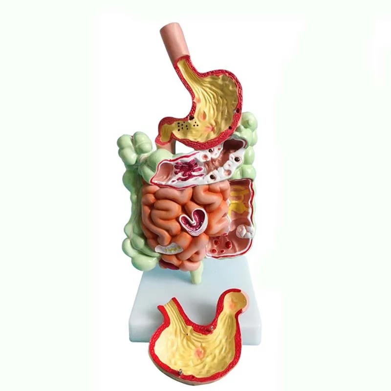 Human Digestive System Anatomy Model Medical Teaching Tools Drop ...