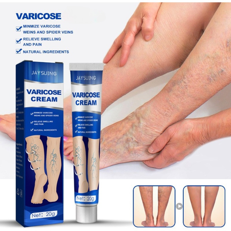 ointment for varicose veins Effective varicose vein relief cream to ...