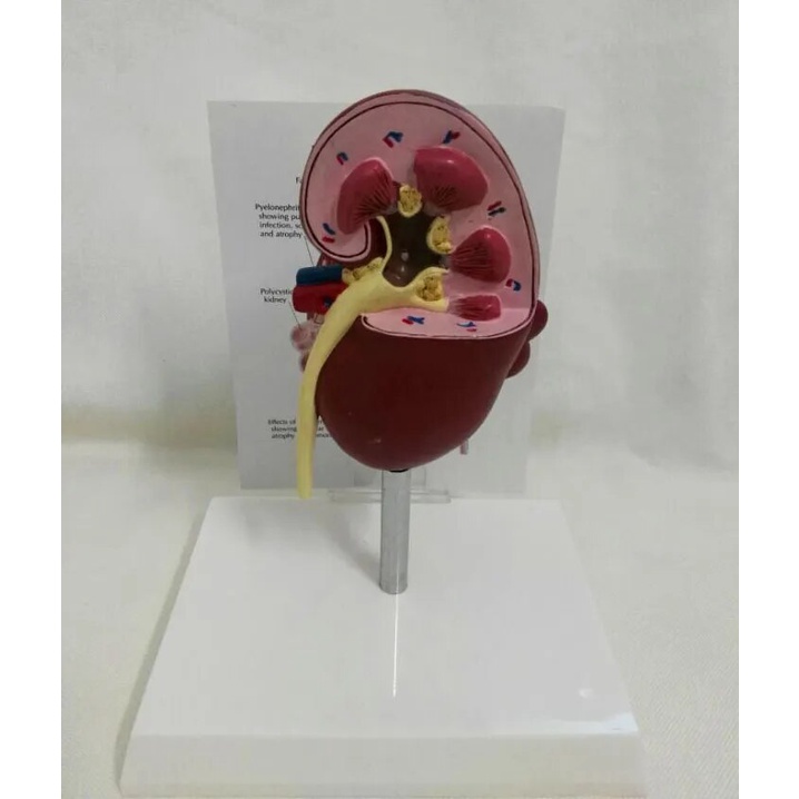 Dog Kidney Morbid Healthy Anatomical Model Canine Pet Teaching Aids ...
