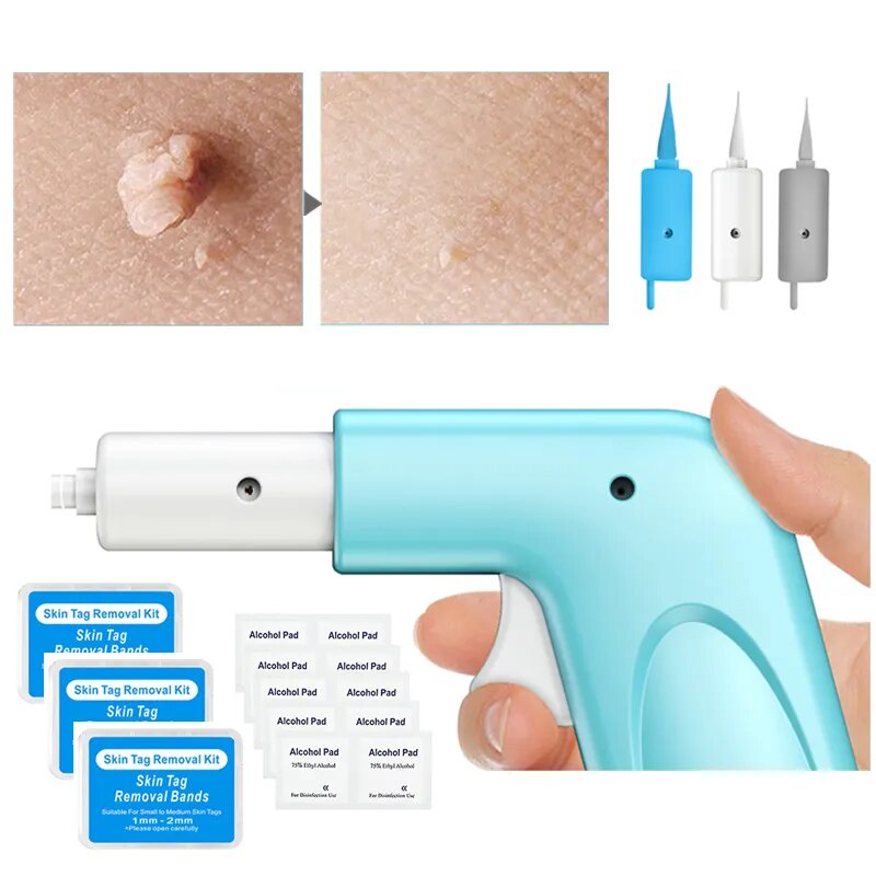 3 In 1 Auto Skin Tag Remover Painless Mole Wart Removal Kit Device ...