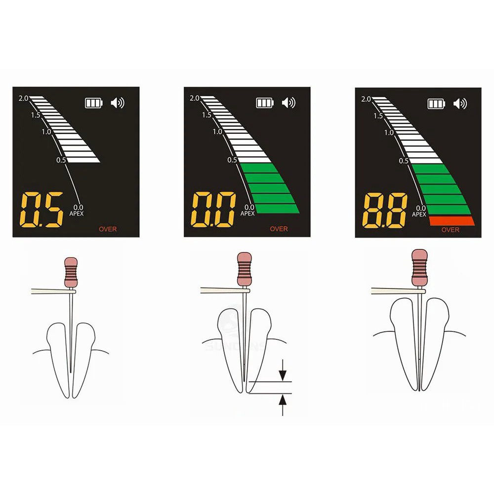 Newly launched Dental Mini Apical Locator Endodontics Surgical Root ...