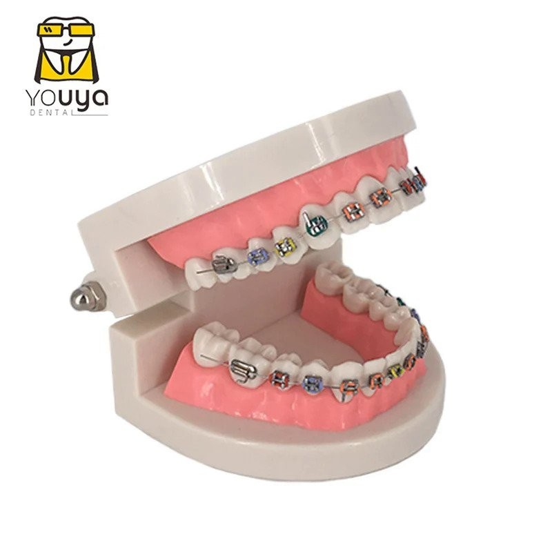 Dental Model With Braces Dentistry Materials Orthodontic Models Gum ...