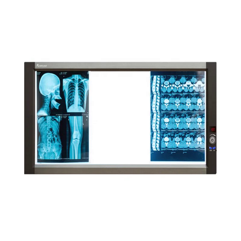 YSX-GPD03 X Ray Machine Triple LED XRay view box Medical X ray ...