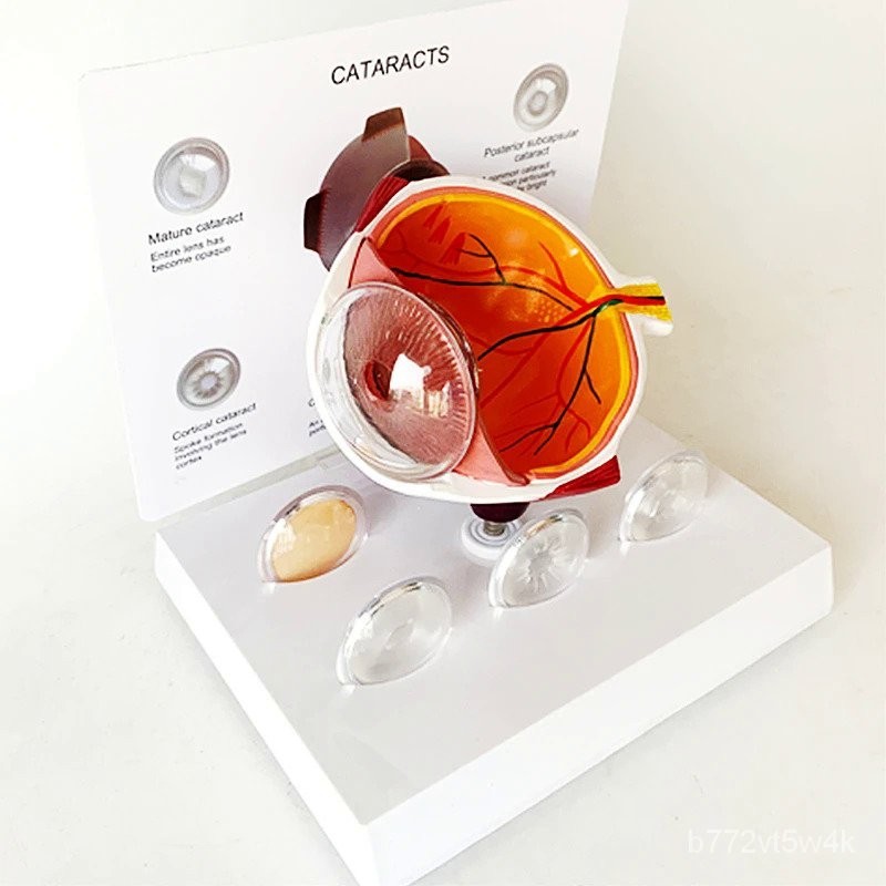 4X Human Pvc Eye Cataract Anatomy Medical Teaching Model EDEL | Shopee ...