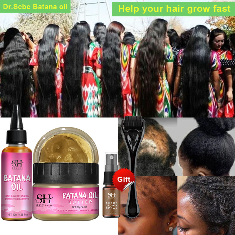 100% Batana Hair Fast Growth Oil Set African Crazy Traction Alopecia ...