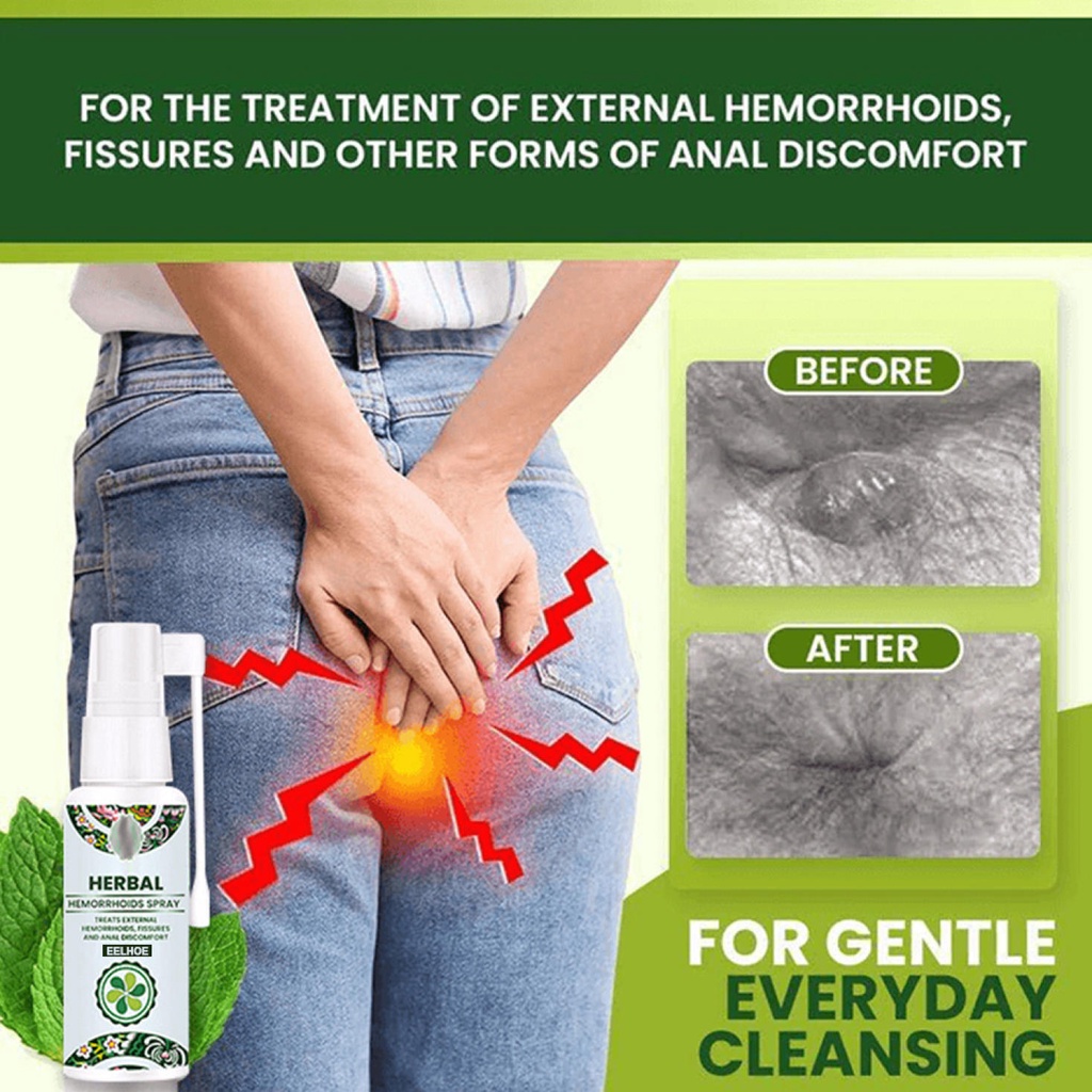 almoranas ointment original hemorrhoids spray Contains herbal extracts ...