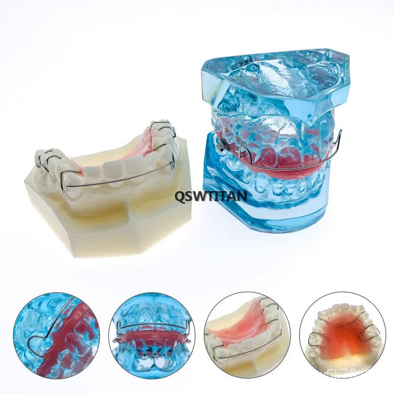 Newly launched Dental Functional Orthopedic Bionator Removable/Hawley ...