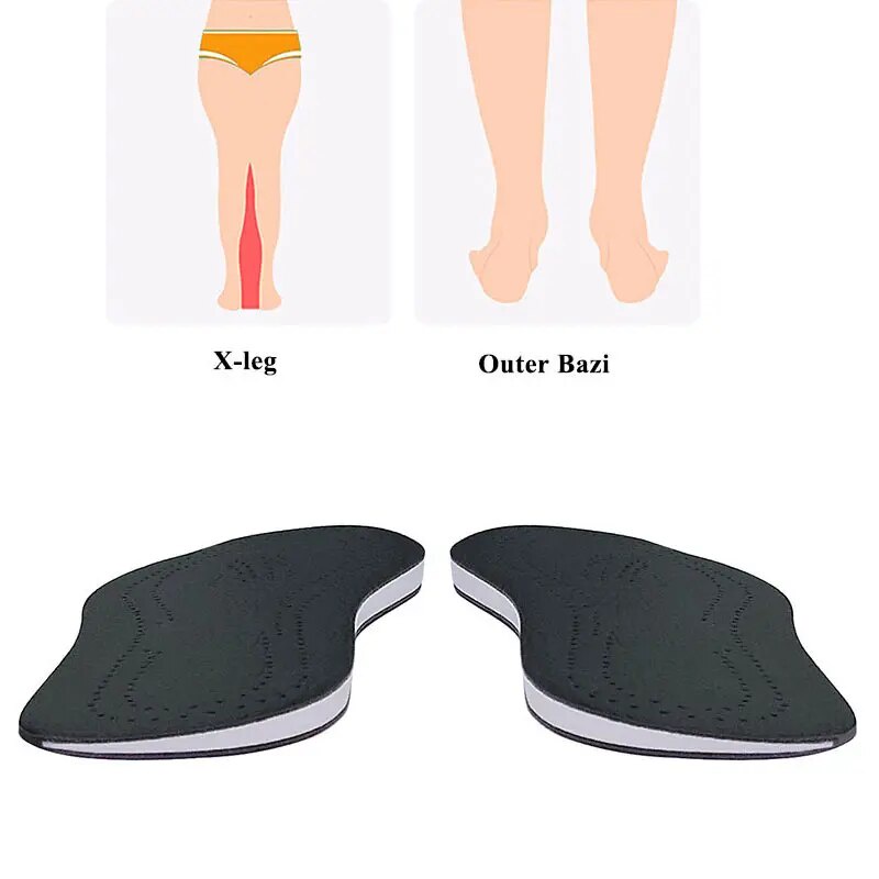 Foot Knock Knee Pain Unisex Leather O/X Leg Orthopedic Insoles Bow Legs ...