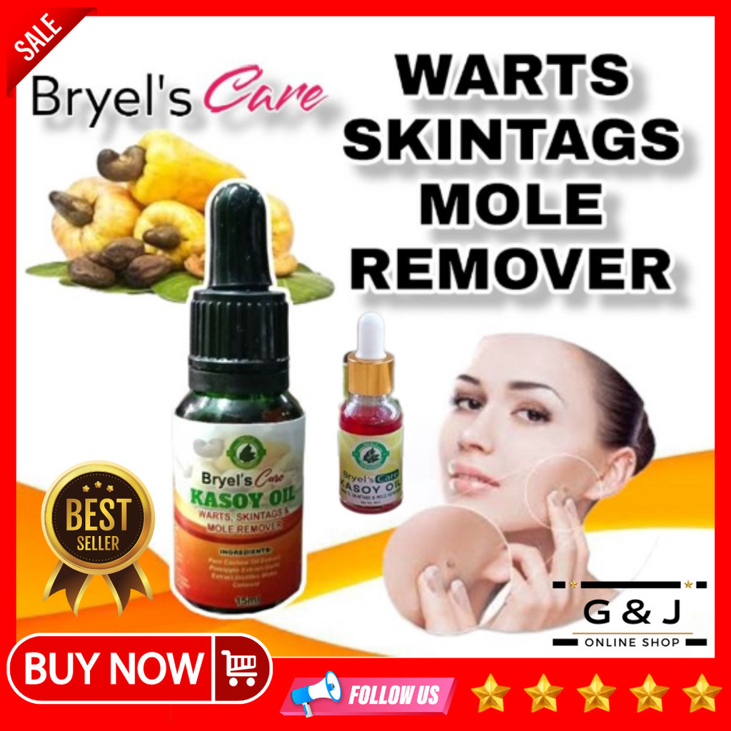 Organic Pure Kasoy Oil 15ML KASOY OIL SOLUTION Warts Remover Skin Tags ...