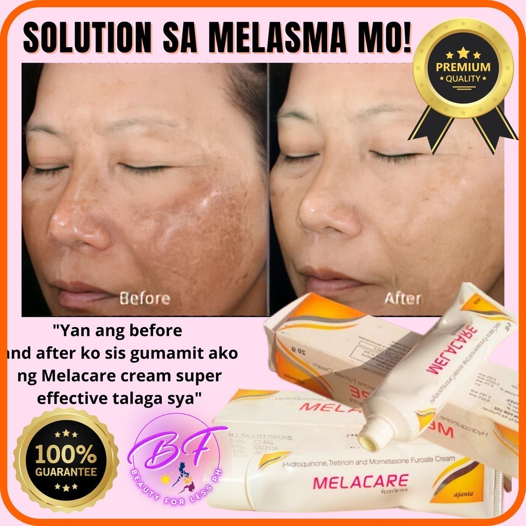112025 Original Melacare Melasma Cream 25grams Pekas Remover Batik