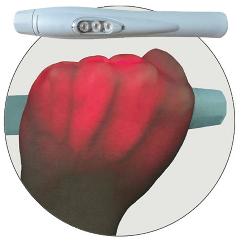 Portable Vein Finder Handheld Intravenous Injection Display Light ...