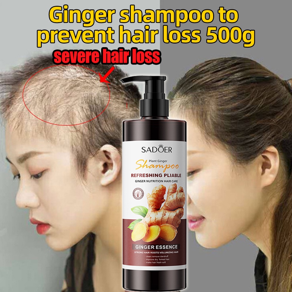 Sadoer Ginger Shampoo And Conditioner For Stronger Hair Roots And Anti