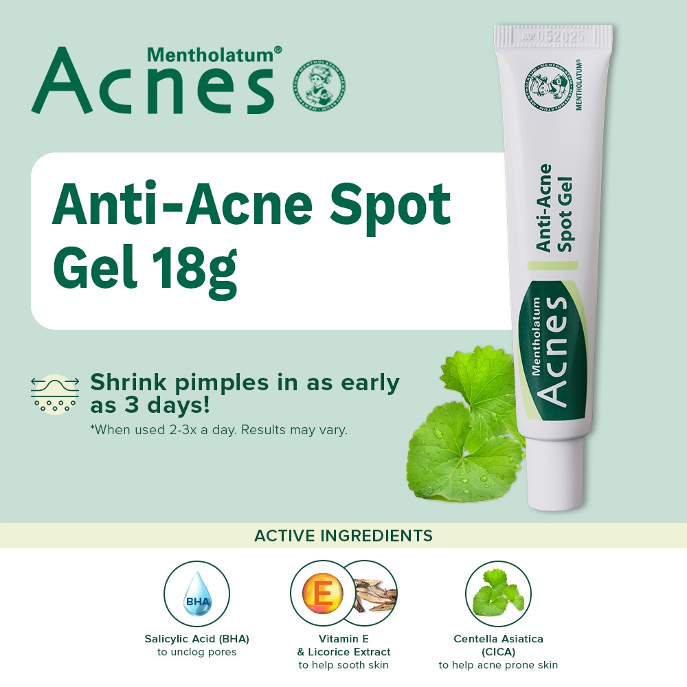 Acnes Anti-Acne Spot Gel 18g | Shopee Philippines