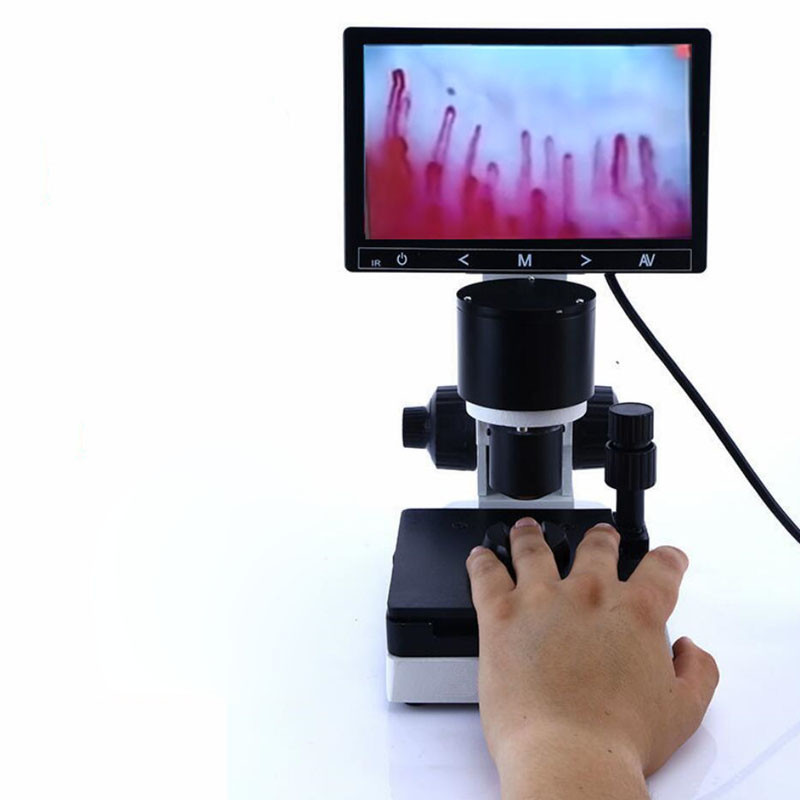 웃Profesional HD Digital Microscope Nailfold Capillary Blood ... 웃Profesional HD Digital Microscope Nailfold Capillary Blood ...