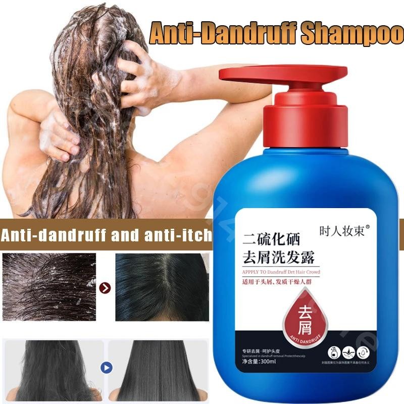Thorough Anti-dandruff Selenium Disulfide Shampoo Oil Control ...