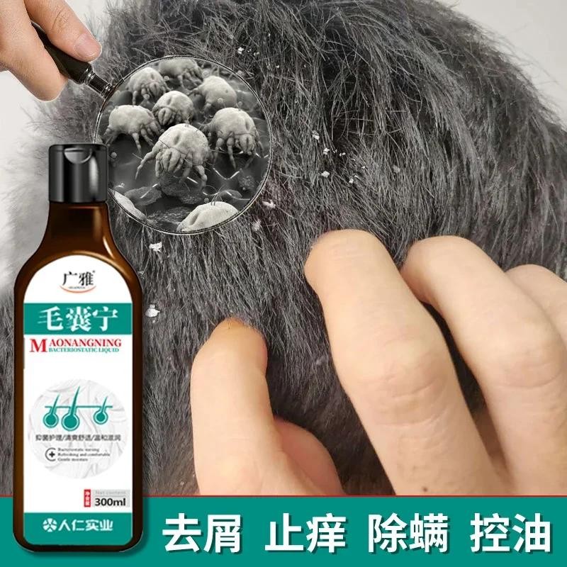 Anti-Dandruff Anti-Itch Shampoo Chinese Herbal Hair Care Mite ...