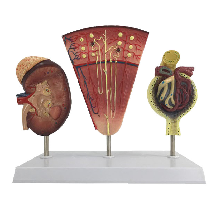 -3D Model Kidney, Nephron and Glomerulus Model, Anatomy Medical kidney ...