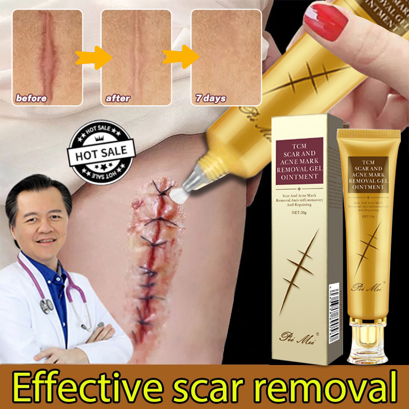 2024 Fix Scar Removal Original Scar Remover Scars Remover For Old Scars
