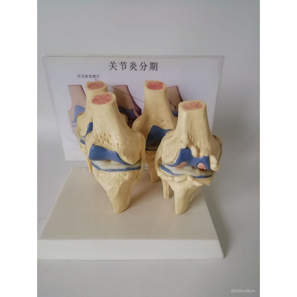 OSWB Model Model Knee Joint Medical Teaching Comparison Knee Joint Bone ...