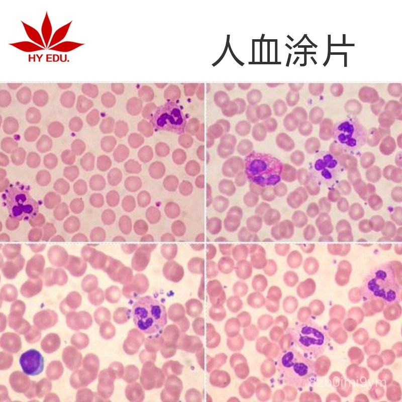 CYVN Stained Glass Slides Biological Clear Human Blood Smear Human ...
