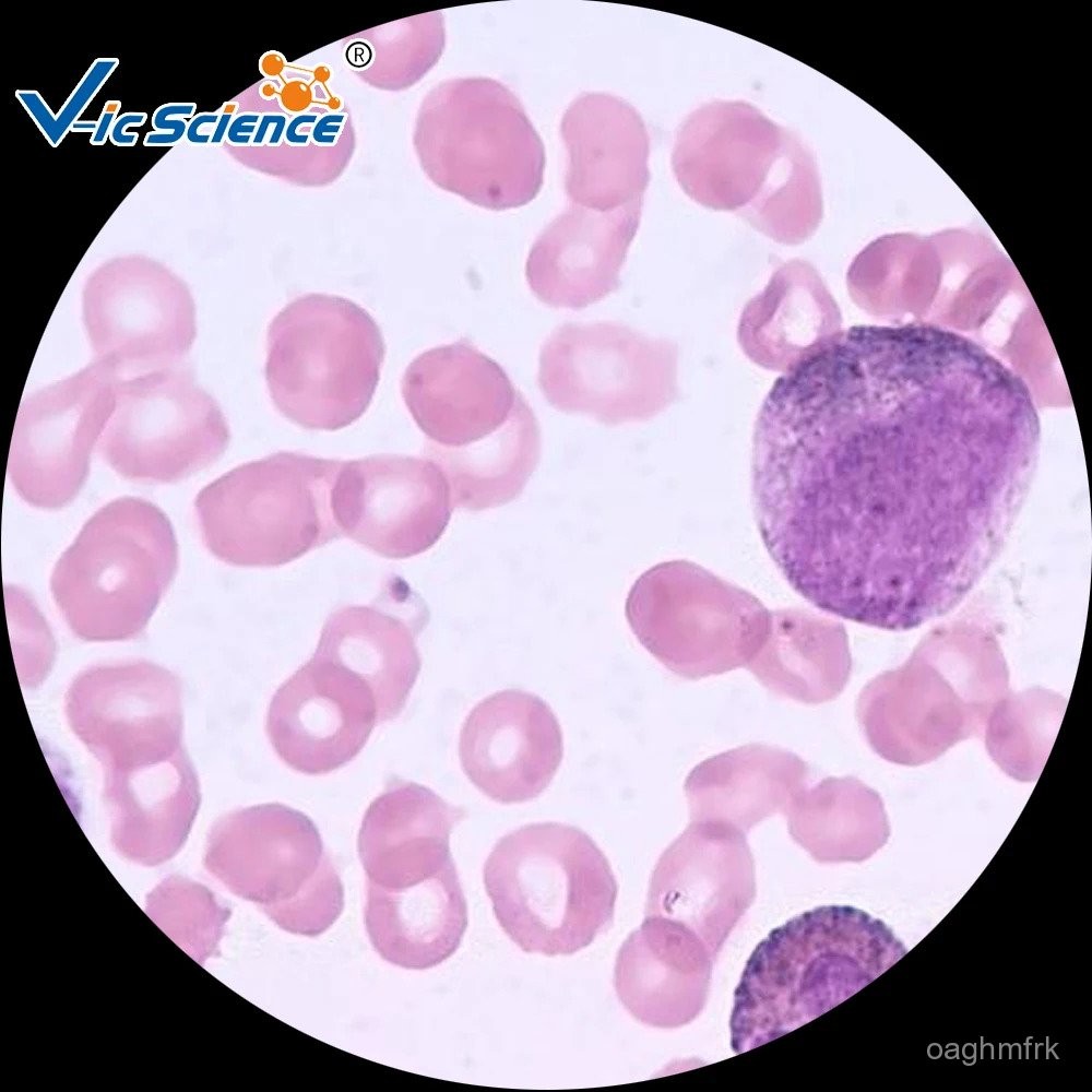 microscope prepared slides hematology prepared slides blood smear ...
