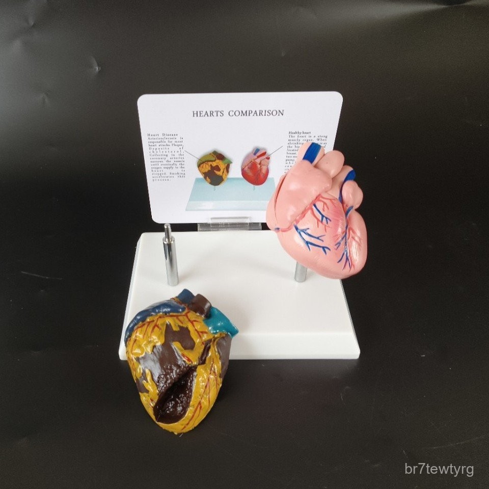 JBQC Human Body Demonstration Comparison and Smoking Illness Human Body ...