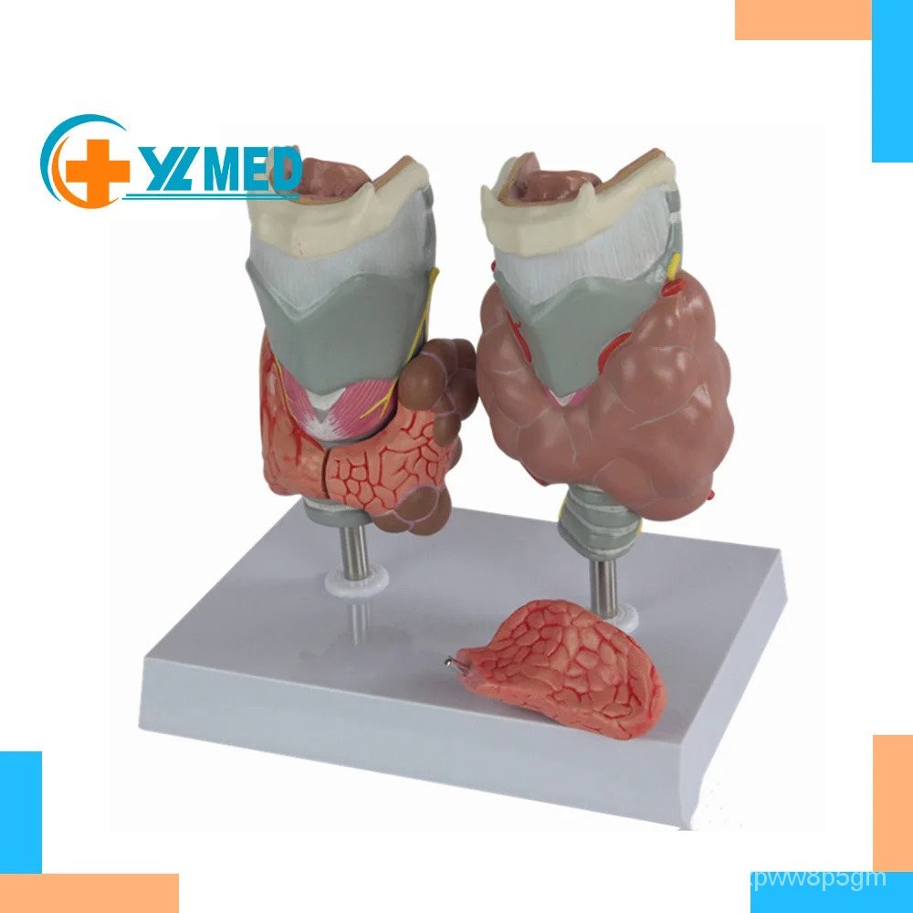 Medical teaching thyroid pathology model Endocrine medicine anatomy ...